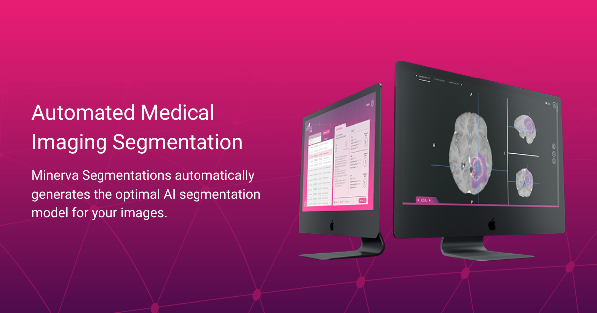 Minerva Segmentations: Automated Medical Imaging Segmentation | Lincbiotech Minerva Segmentations: Automated Medical Imaging Segmentation | Lincbiotech